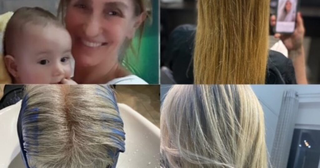 Cabelos grisalhos Canície Capilar Precoce/Menopausa - Dra. Amira Hazime